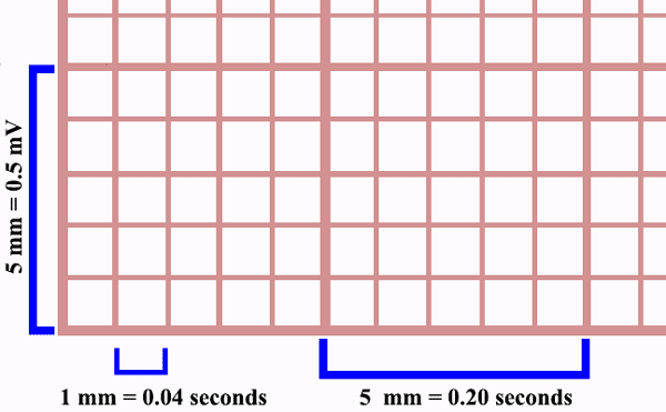 Elektrocardiogram papier Trend Repository